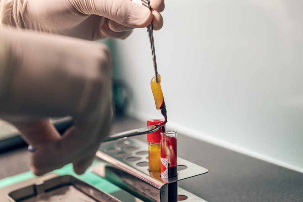 Expert Guide: PRF Injections for Healing and Recovery