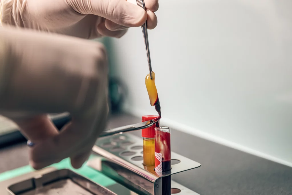 Understanding PRF Injections: Your Guide to Treatment